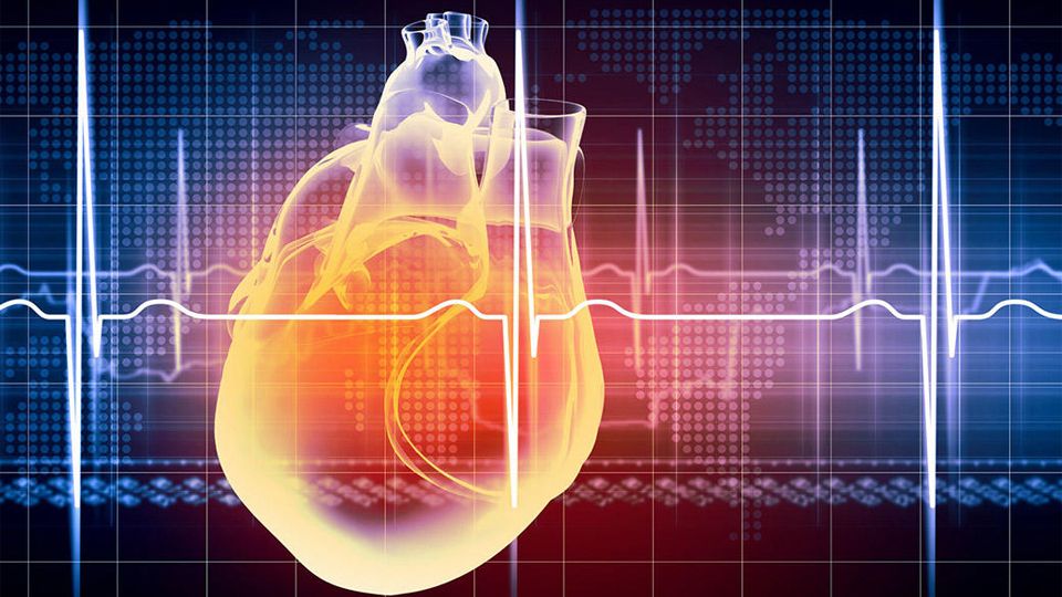Cardiovascular Department :: CIC-P de Bordeaux